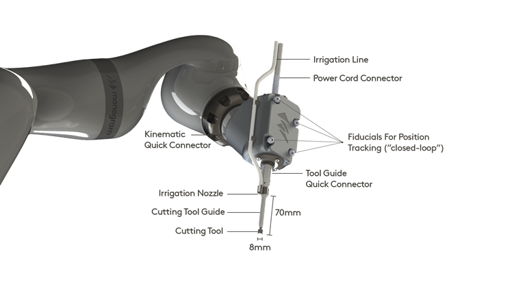 Innovative Robotics for orthopedic medicine | KUKA AG