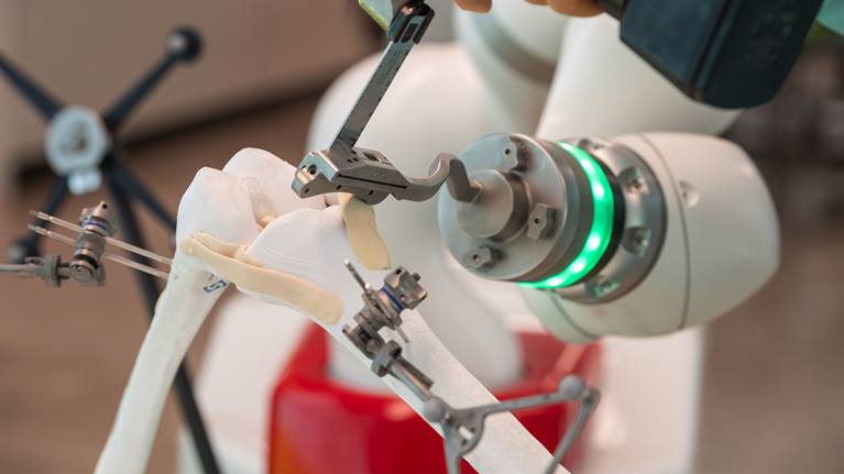 Robotic knee surgery with the robot system "ROBIN" at a new level | KUKA AG