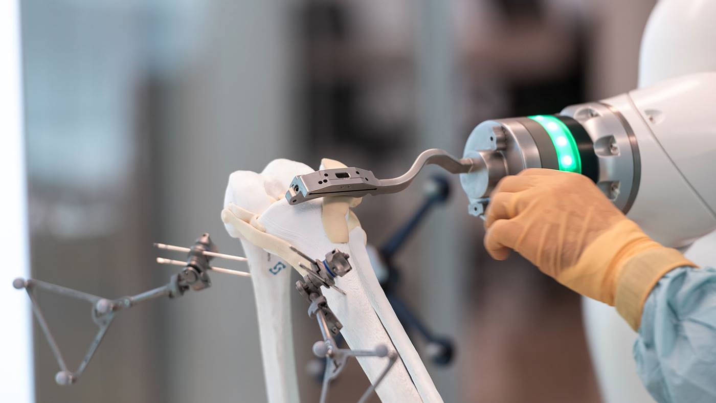 Robotic knee surgery with the robot system "ROBIN" at a new level | KUKA AG
